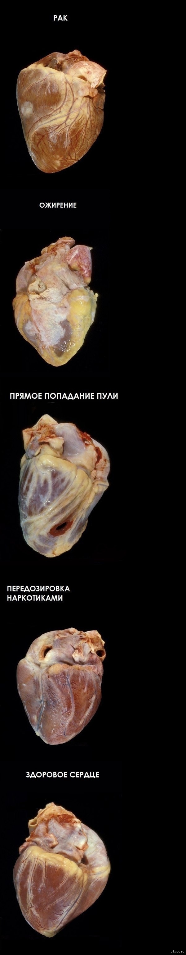 Сердца разных людей | Пикабу